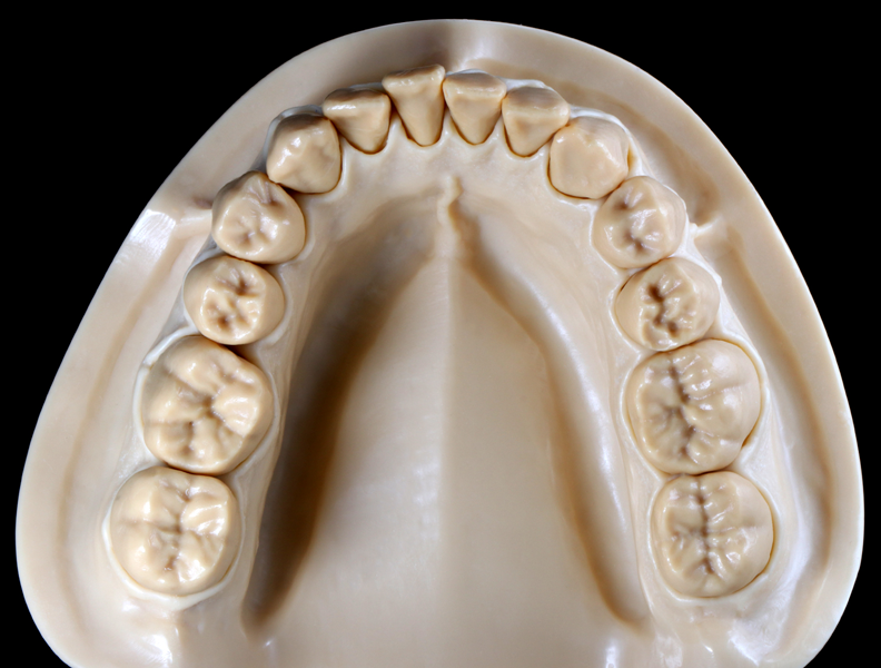 Dentalligent.store | DEMO Modell S2 - UK - each 14 teeth removeable ...