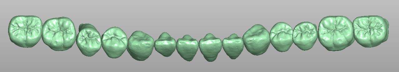 Dentalligent.store | STL-FILES - 28 root teeth individually in full ...
